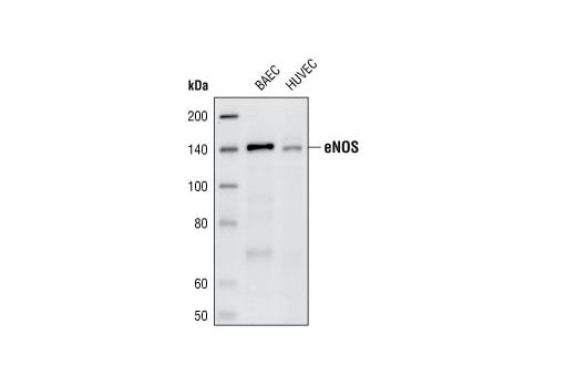 eNOS (49G3) Rabbit mAb | Cell Signaling Technology