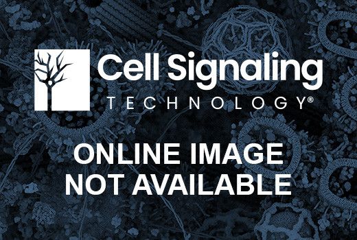 Total YAP Matched Antibody Pair | Cell Signaling Technology