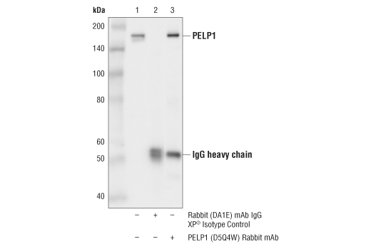 PELP1 (D5Q4W) Rabbit mAb (#96986) Datasheet With Images | Cell ...