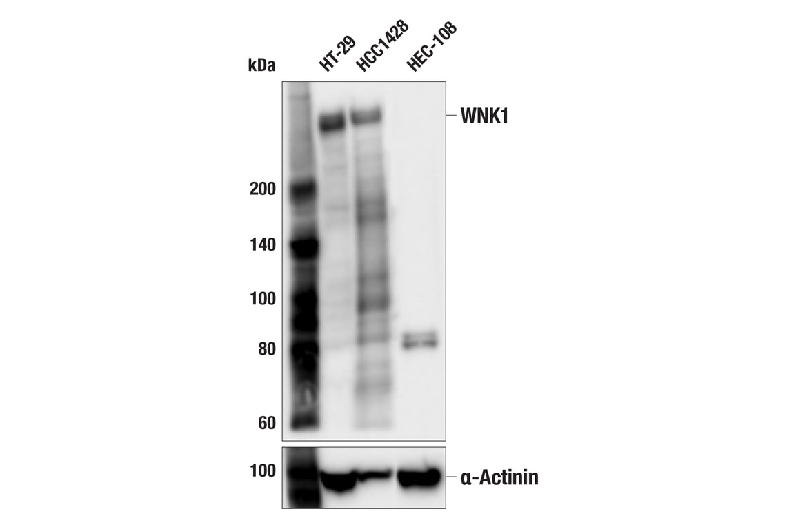 WNK1 (F1O3U) Rabbit mAb | Cell Signaling Technology