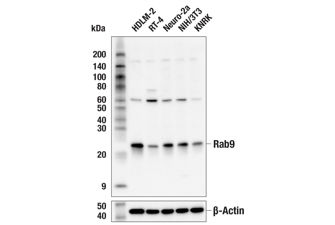 Rab9A (E2I3T) Mouse mAb | Cell Signaling Technology
