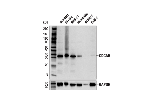 CDCA5 (E7M3N) Rabbit mAb | Cell Signaling Technology