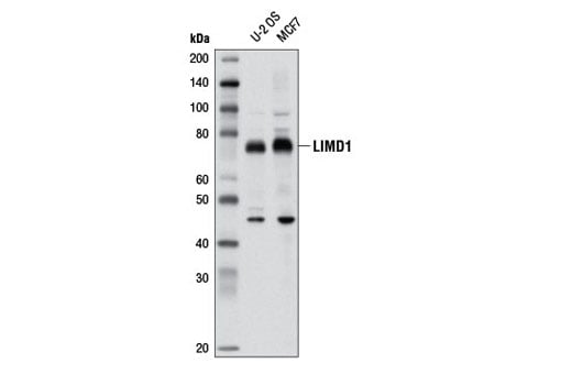 LIMD1 Antibody | Cell Signaling Technology