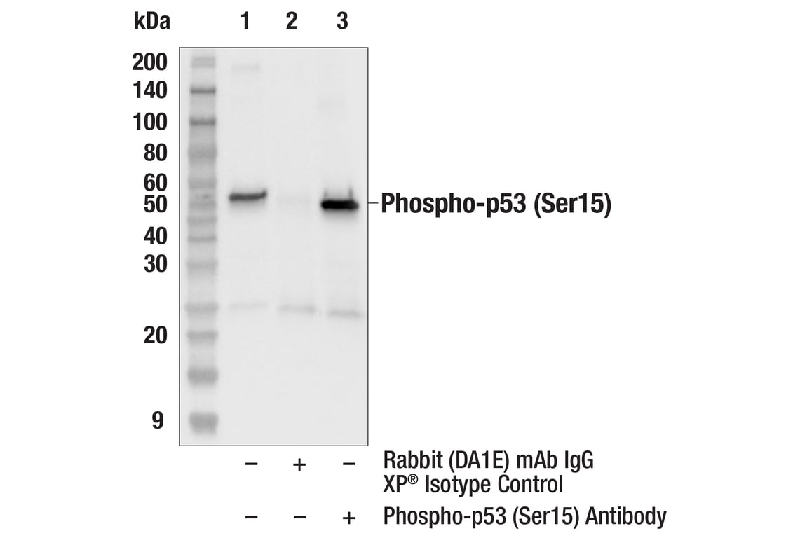 Phospho-p53 (Ser15) Antibody (#9284) Datasheet With Images | Cell ...