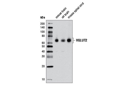 VGLUT2 Antibody | Cell Signaling Technology