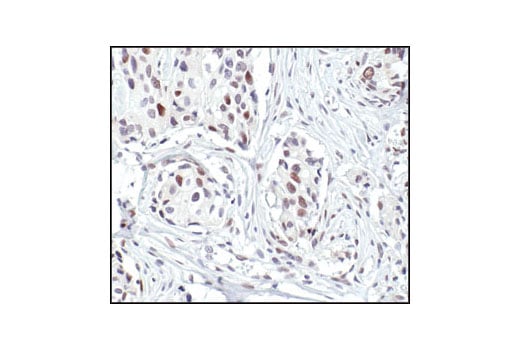 FosB (5G4) Rabbit mAb (#2251) Datasheet With Images | Cell Signaling ...