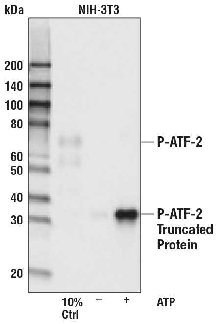 ATP (10 mM) | Cell Signaling Technology