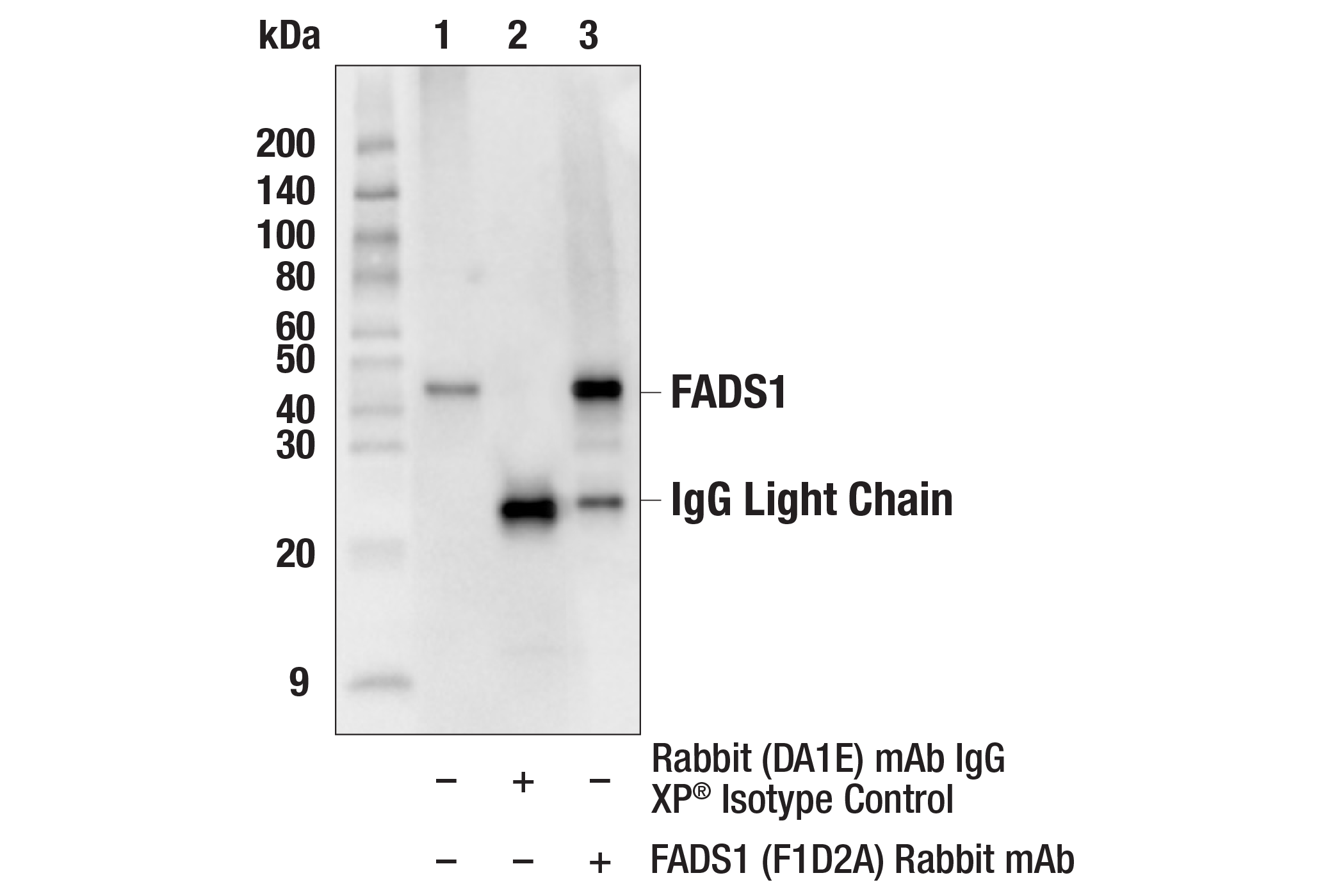 FADS1 (F1D2A) Rabbit mAb | Cell Signaling Technology