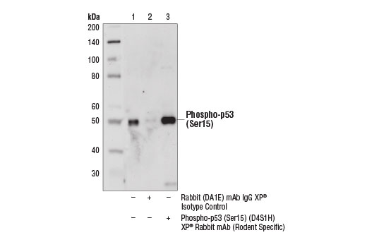 Phospho-p53 (Ser15) (D4S1H) Rabbit mAb (Rodent Specific) | Cell ...