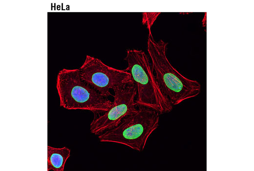 DyLight™ 594 Phalloidin | Cell Signaling Technology