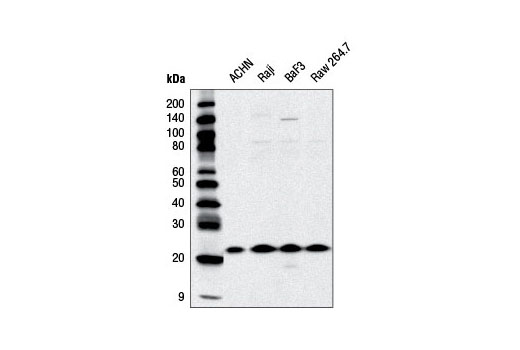 CBF beta Antibody | Cell Signaling Technology
