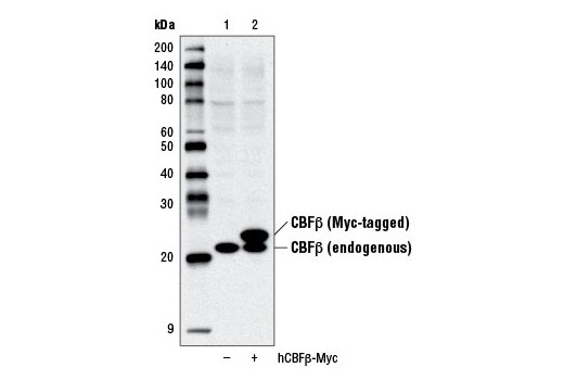 CBF beta Antibody | Cell Signaling Technology