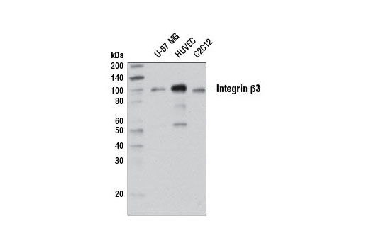 Integrin beta 3 Antibody (D7X3P) | Cell Signaling Technology