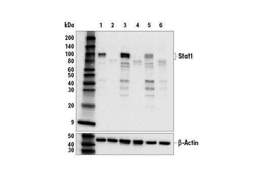 PhosphoPlus® Stat1 (Tyr701) Antibody Duet | Cell Signaling Technology