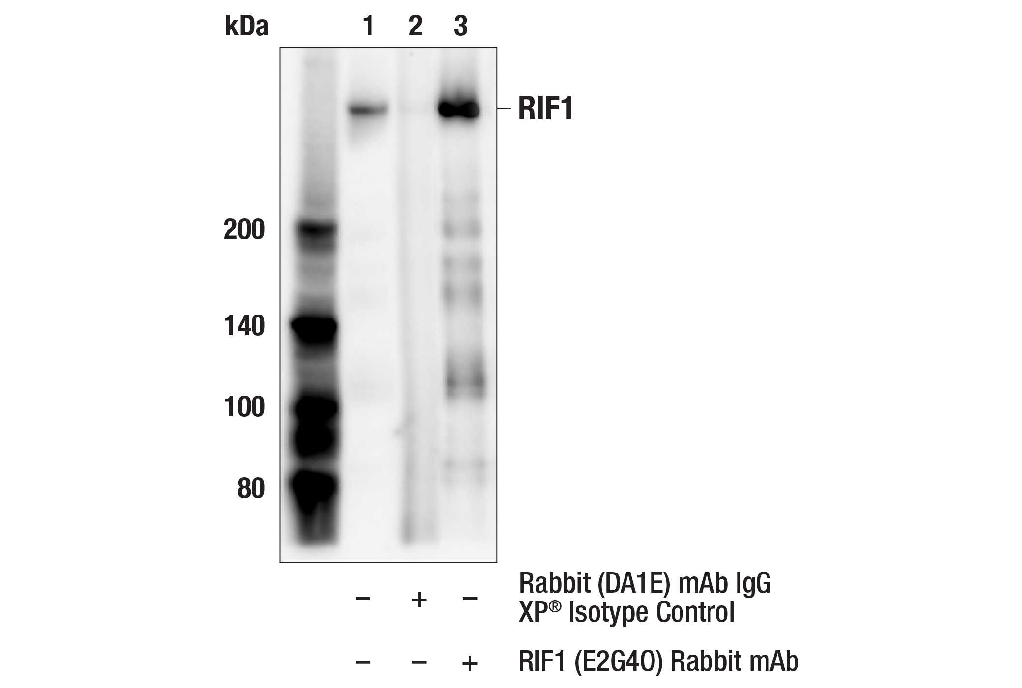 RIF1 (E2G4O) Rabbit mAb | Cell Signaling Technology
