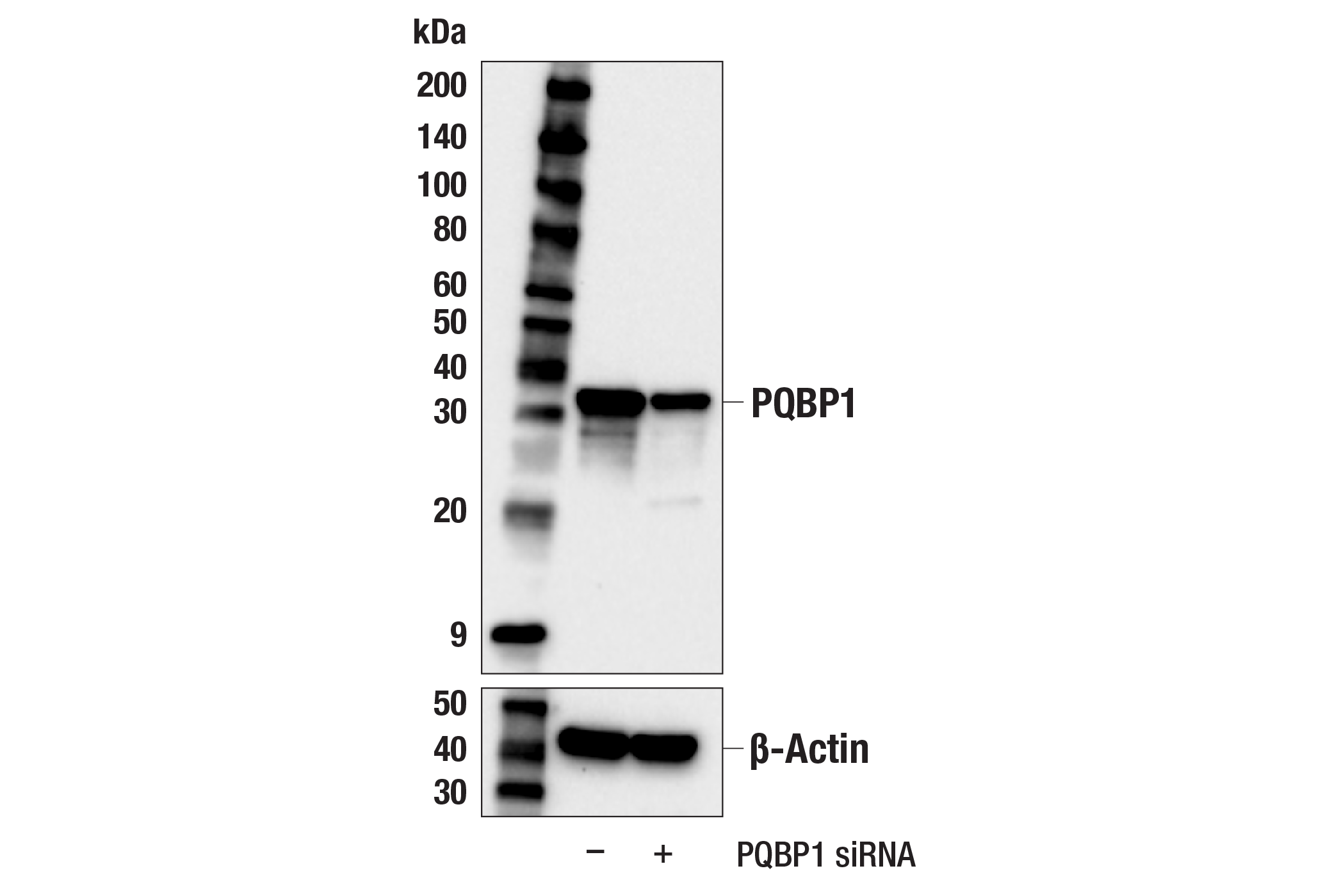 PQBP1 (E5N7J) Rabbit mAb | Cell Signaling Technology