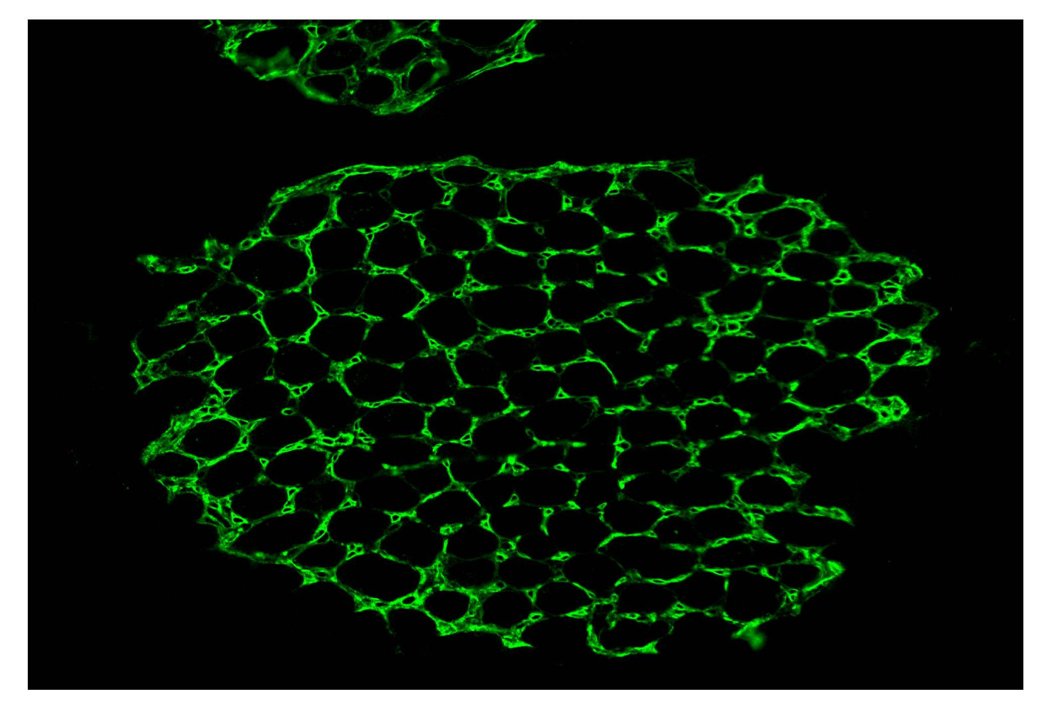 CD39/NTPDase 1 (E2X6B) & CO-0076-594 SignalStar™ Oligo-Antibody Pair ...