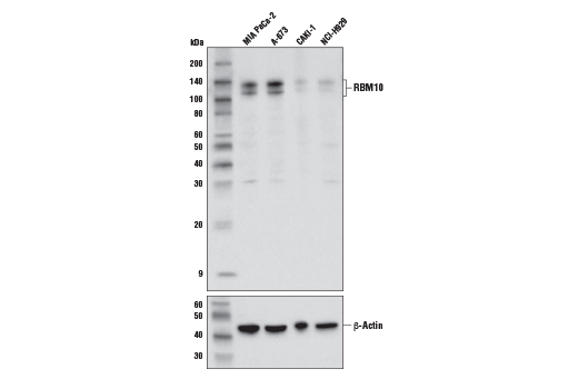 RBM10 Antibody | Cell Signaling Technology