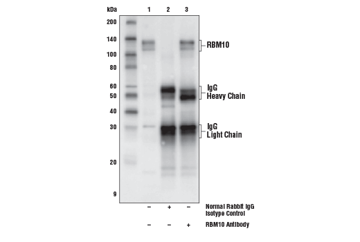 RBM10 Antibody | Cell Signaling Technology