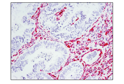 SignalStain® Boost IHC Detection Reagent (AP, Rabbit) | Cell Signaling ...