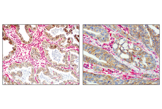 SignalStain® Boost IHC Detection Reagent (AP, Rabbit) | Cell Signaling ...