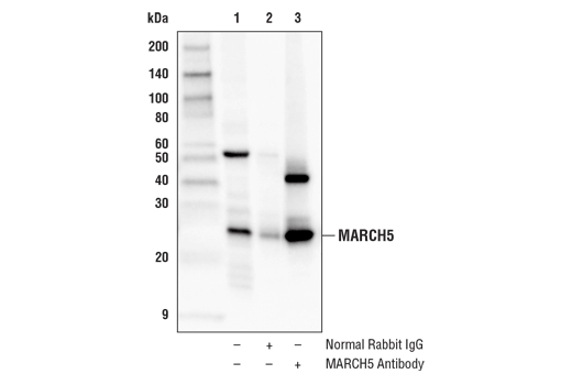 MARCH5 Antibody | Cell Signaling Technology