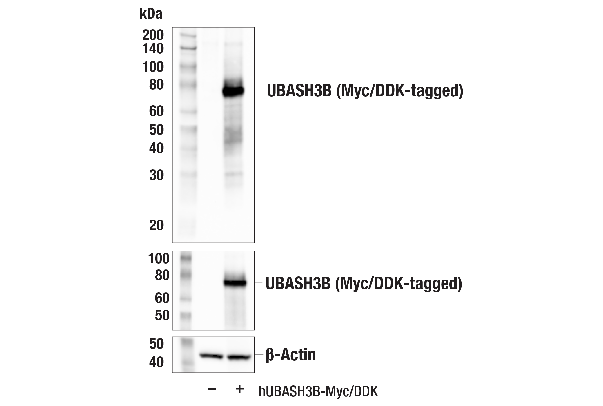 UBASH3B (E1A8Y) Rabbit mAb | Cell Signaling Technology