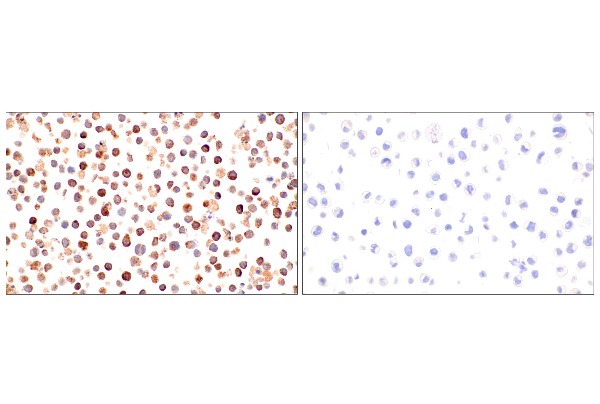 Eosinophil cationic protein (E6U5M) Rabbit mAb (BSA and Azide Free ...