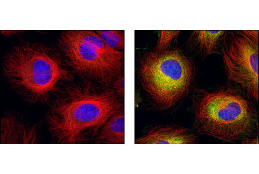 β-Tubulin (9F3) Rabbit mAb (Alexa Fluor® 555 Conjugate) | Cell ...