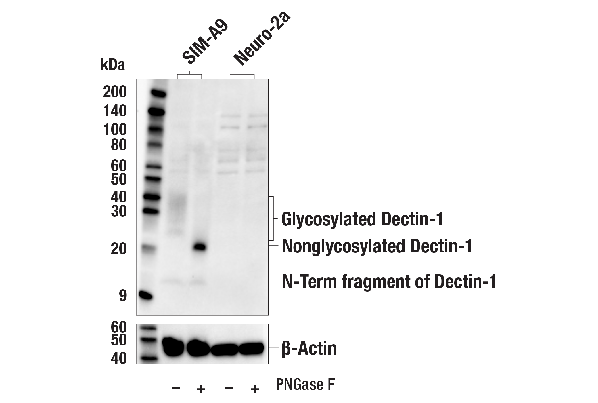 Dectin-1 Antibody | Cell Signaling Technology
