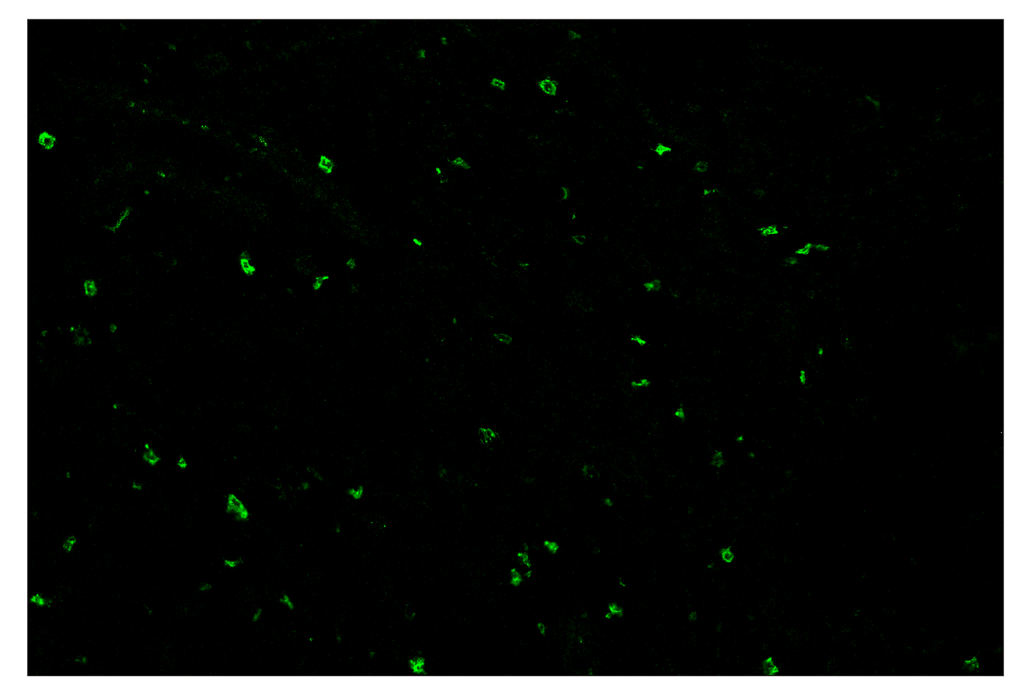 XCR1 (D2F8T) & CO-0015-488 SignalStar™ Oligo-Antibody Pair | Cell Signaling Technology
