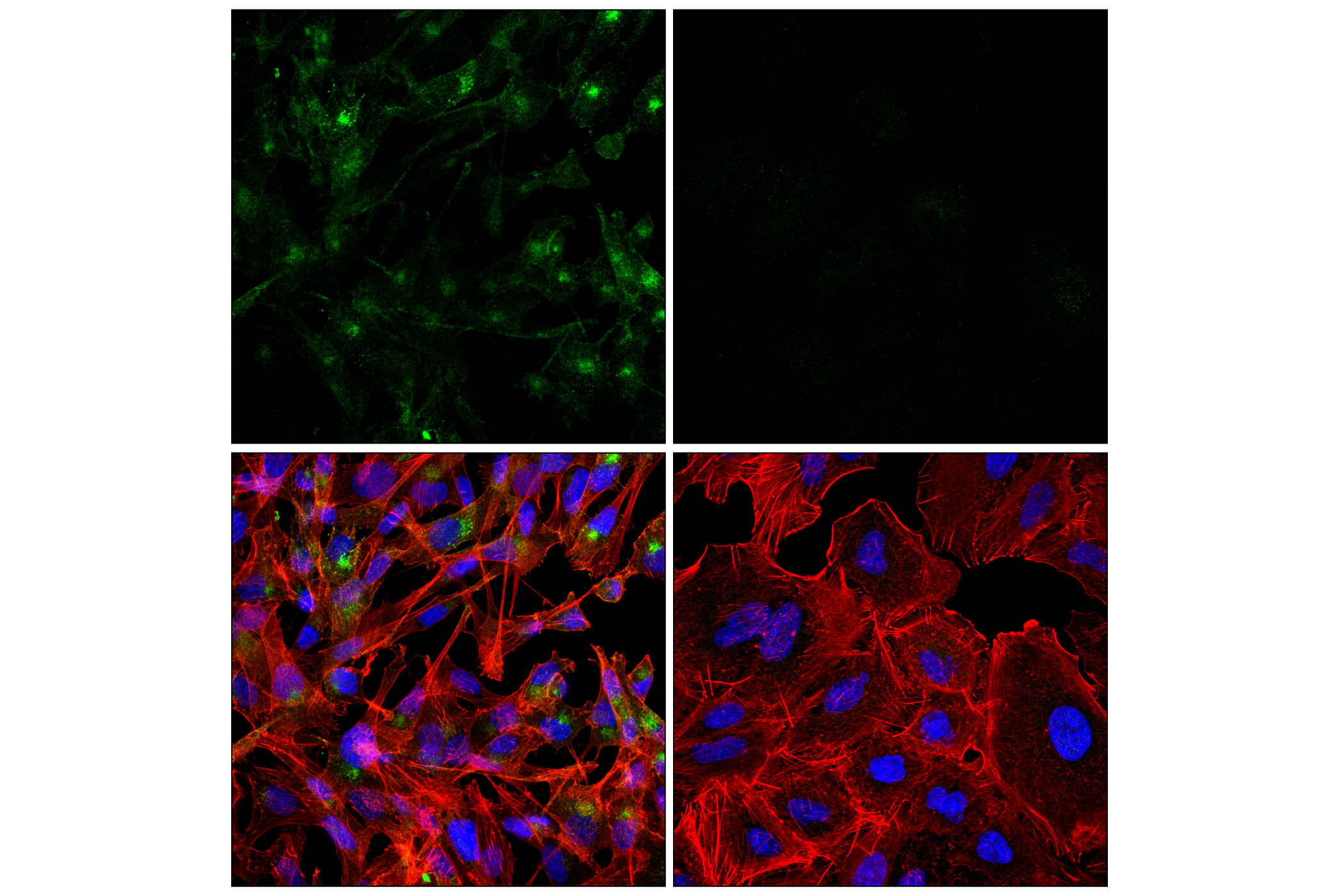 DDR2 (E6V2N) Rabbit mAb | Cell Signaling Technology