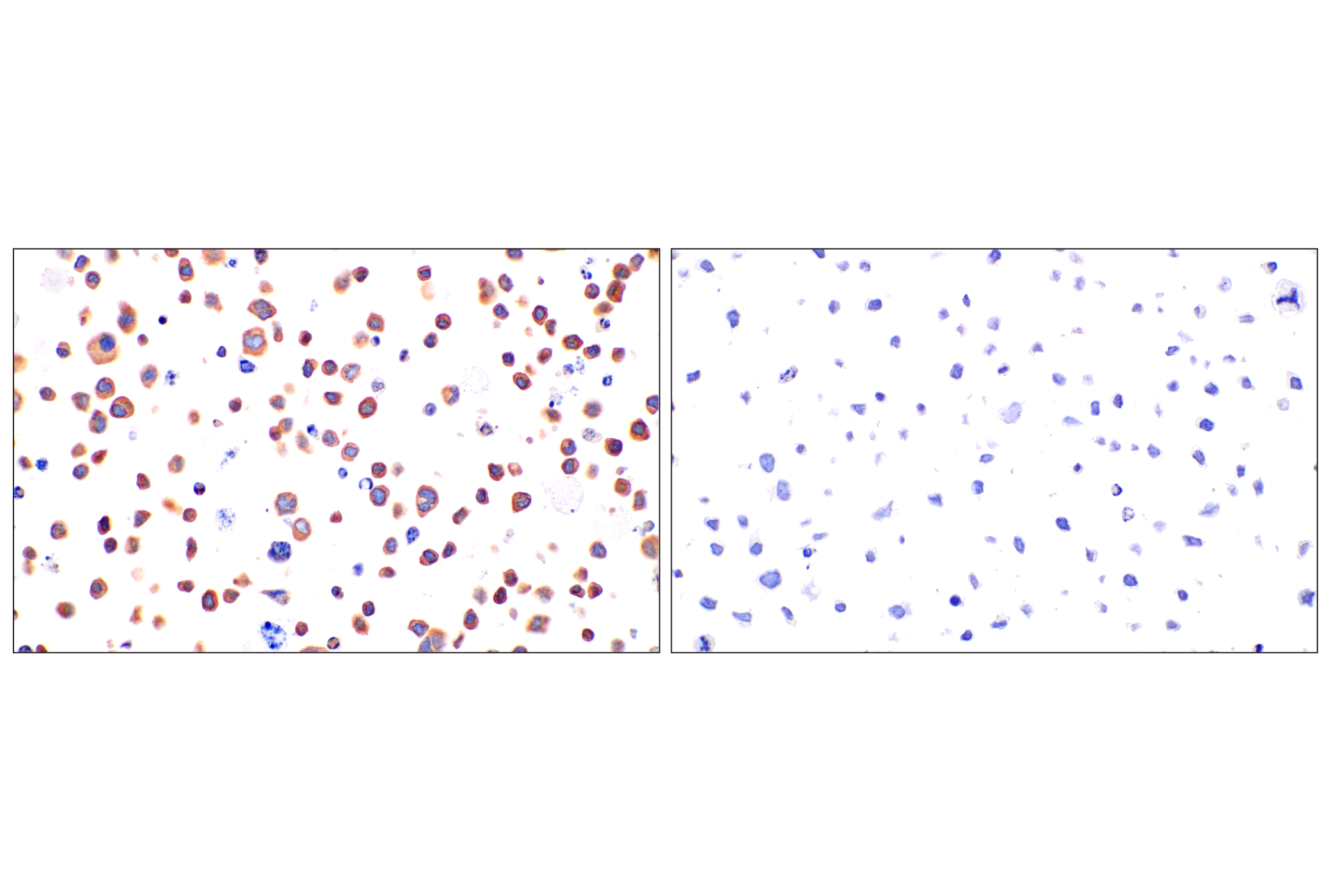 LZTFL1 (E9R7T) Rabbit mAb | Cell Signaling Technology