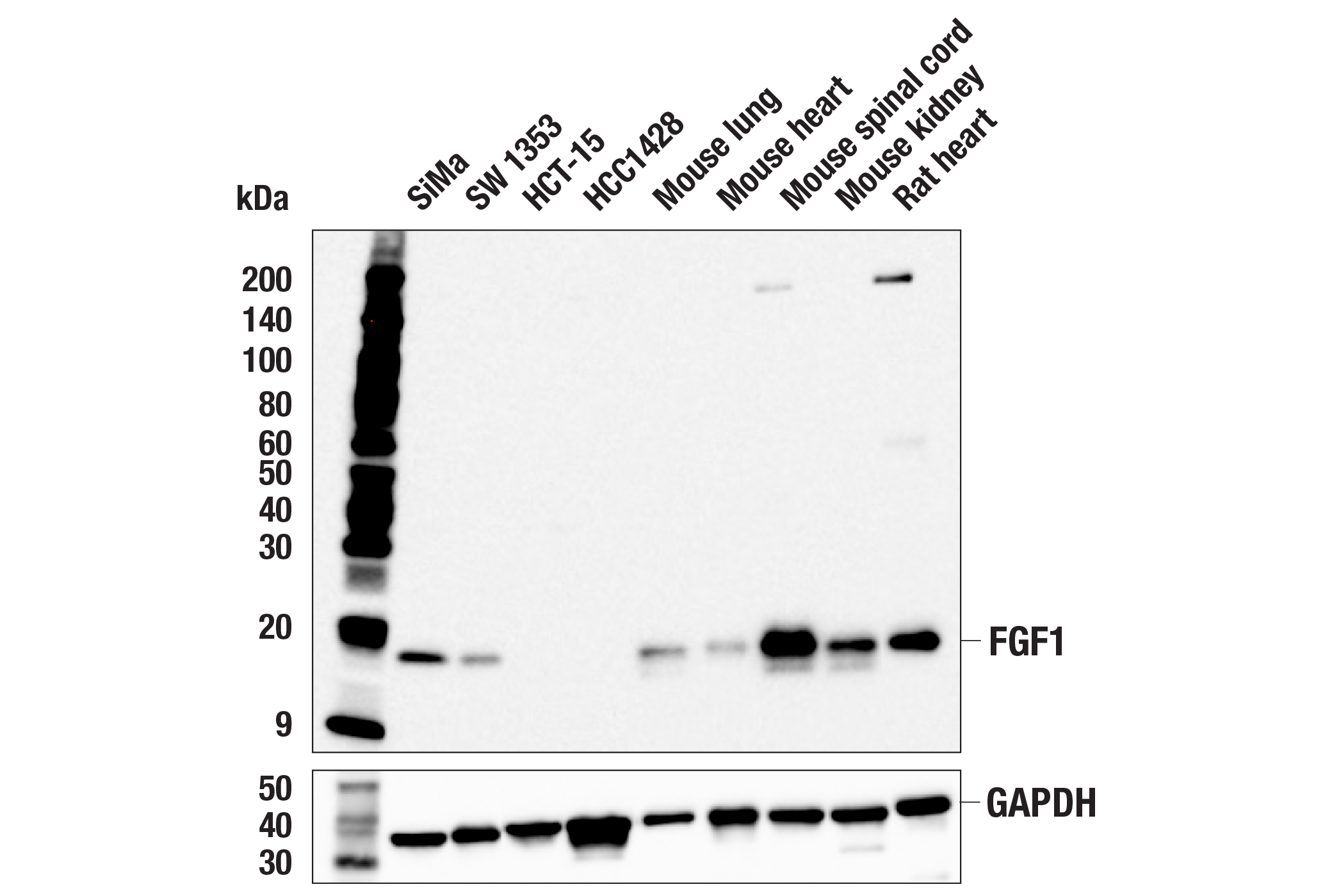 FGF1 (E2S9Q) Rabbit mAb | Cell Signaling Technology