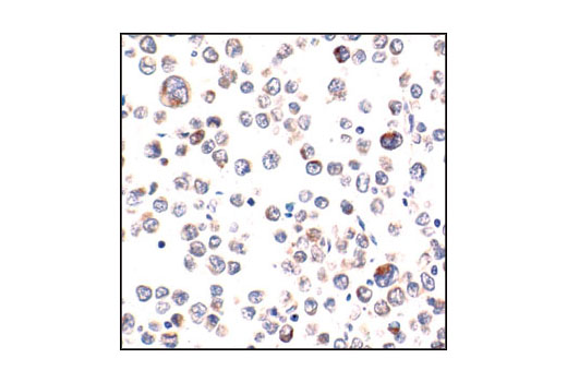 Bax Antibody | Cell Signaling Technology