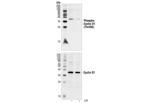 Phospho-Cyclin D1 (Thr286) Antibody | Cell Signaling Technology