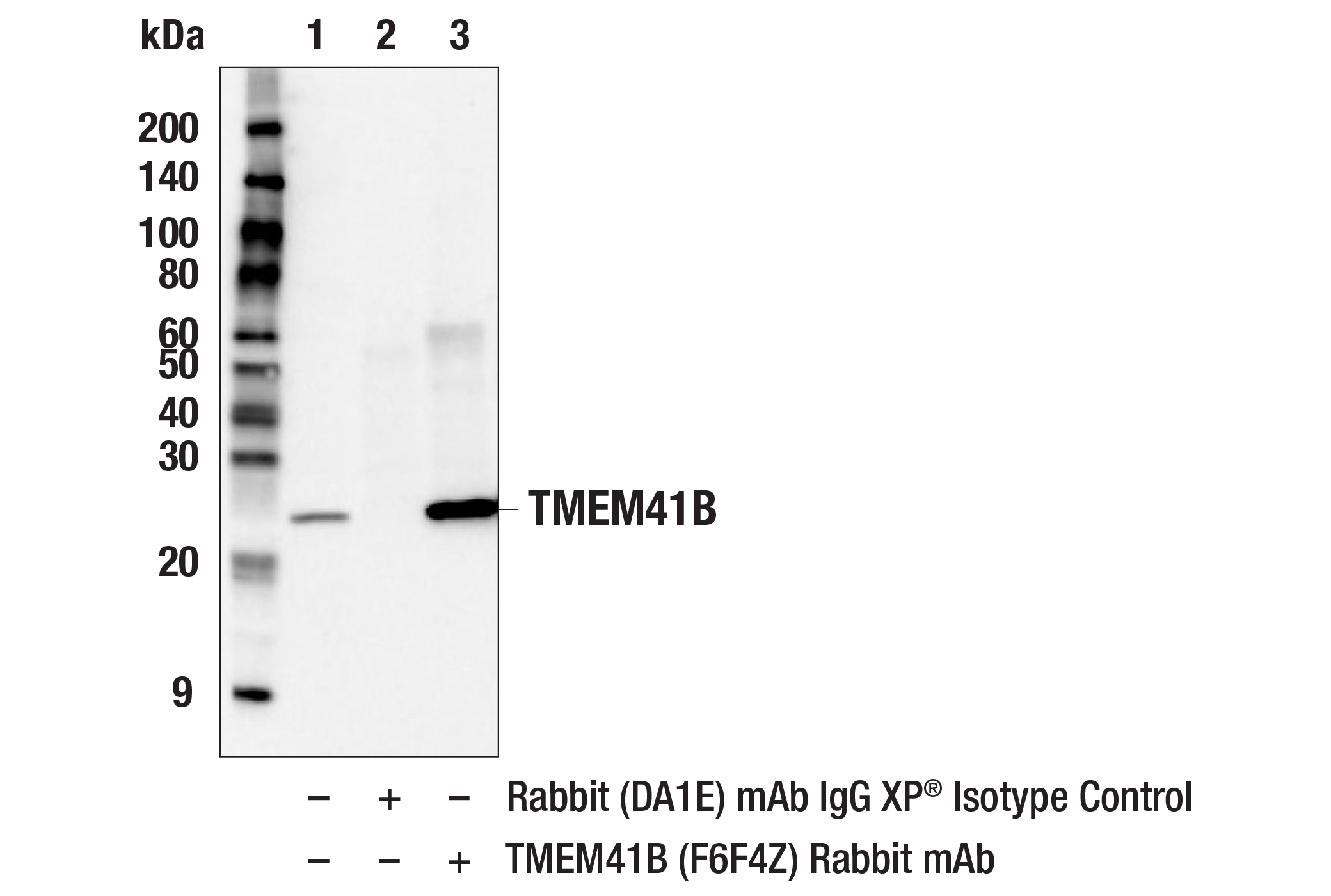 TMEM41B (F6F4Z) Rabbit mAb | Cell Signaling Technology