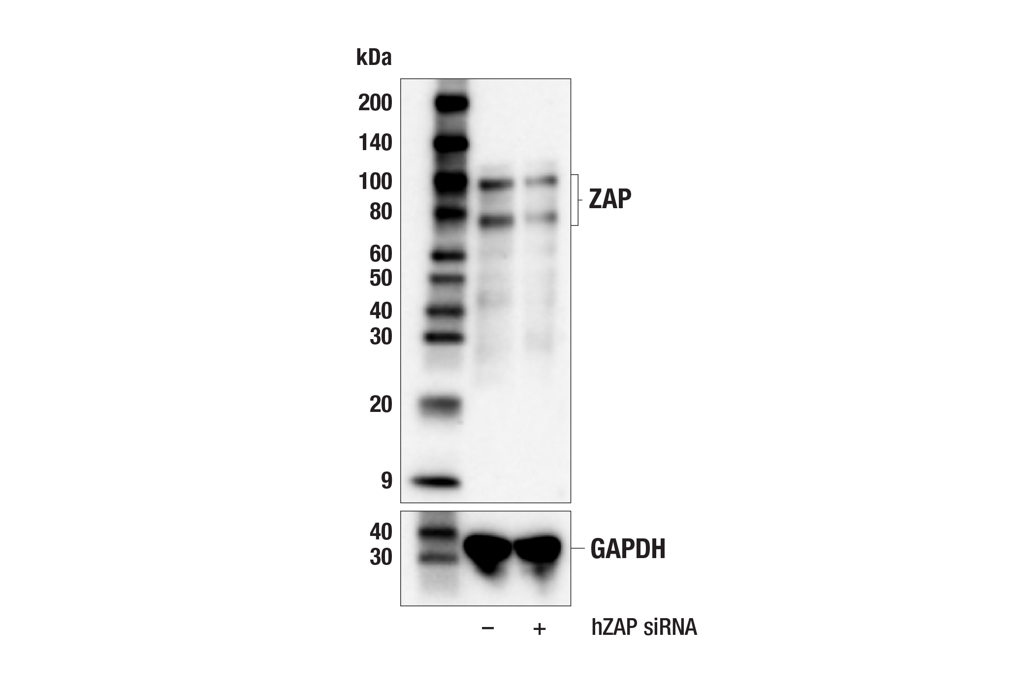 ZAP (E5V4D) Rabbit mAb | Cell Signaling Technology