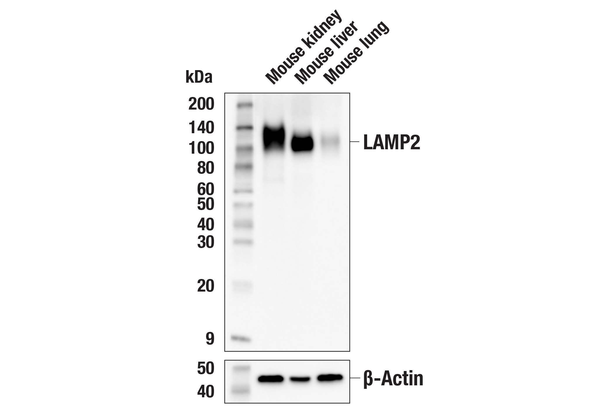LAMP2 (E6A6S) Rabbit mAb | Cell Signaling Technology