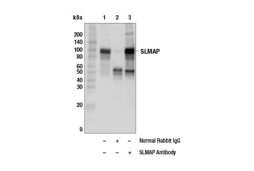 SLMAP Antibody | Cell Signaling Technology