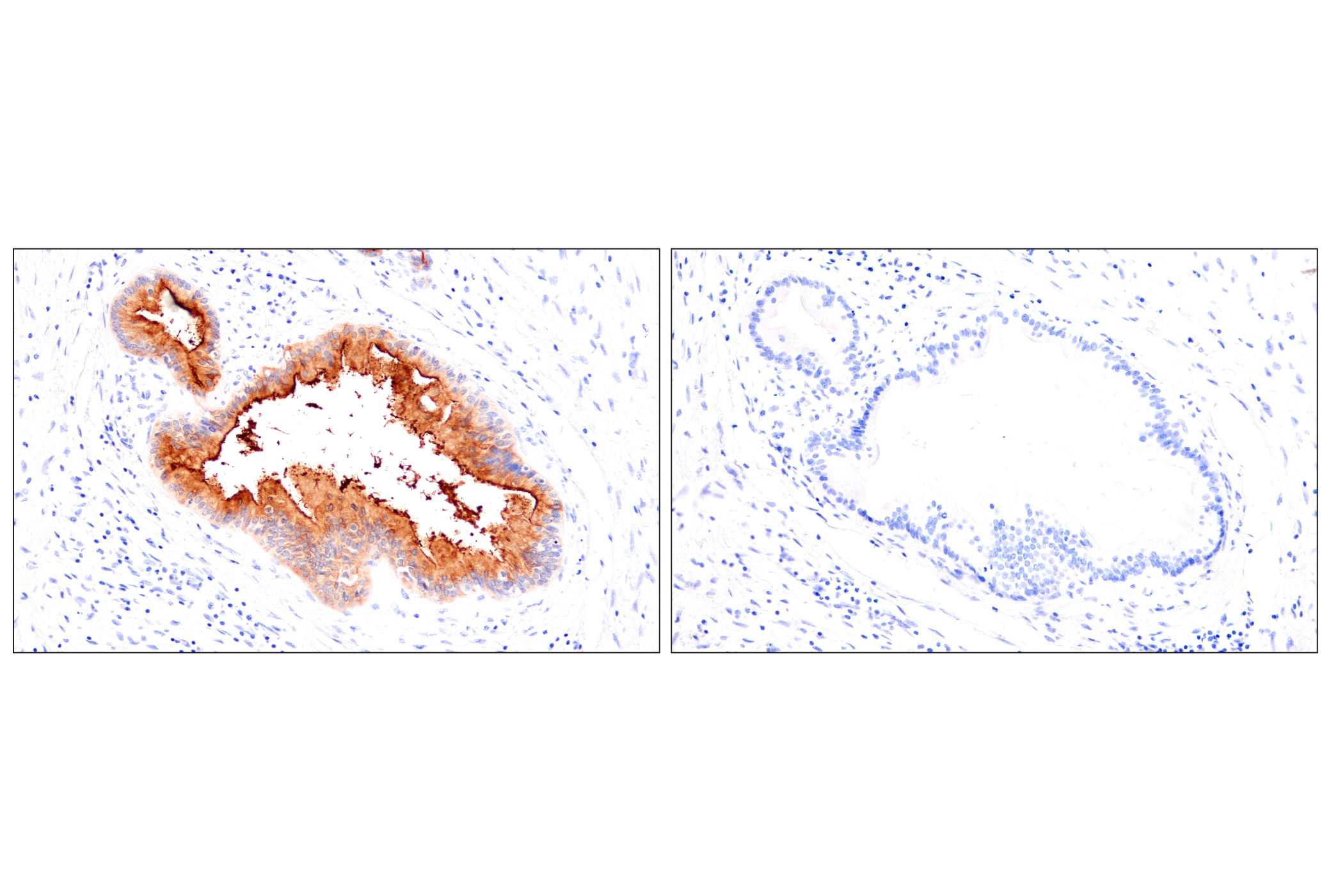CEACAM7 (E5Q6X) Rabbit mAb (BSA and Azide Free) | Cell Signaling Technology