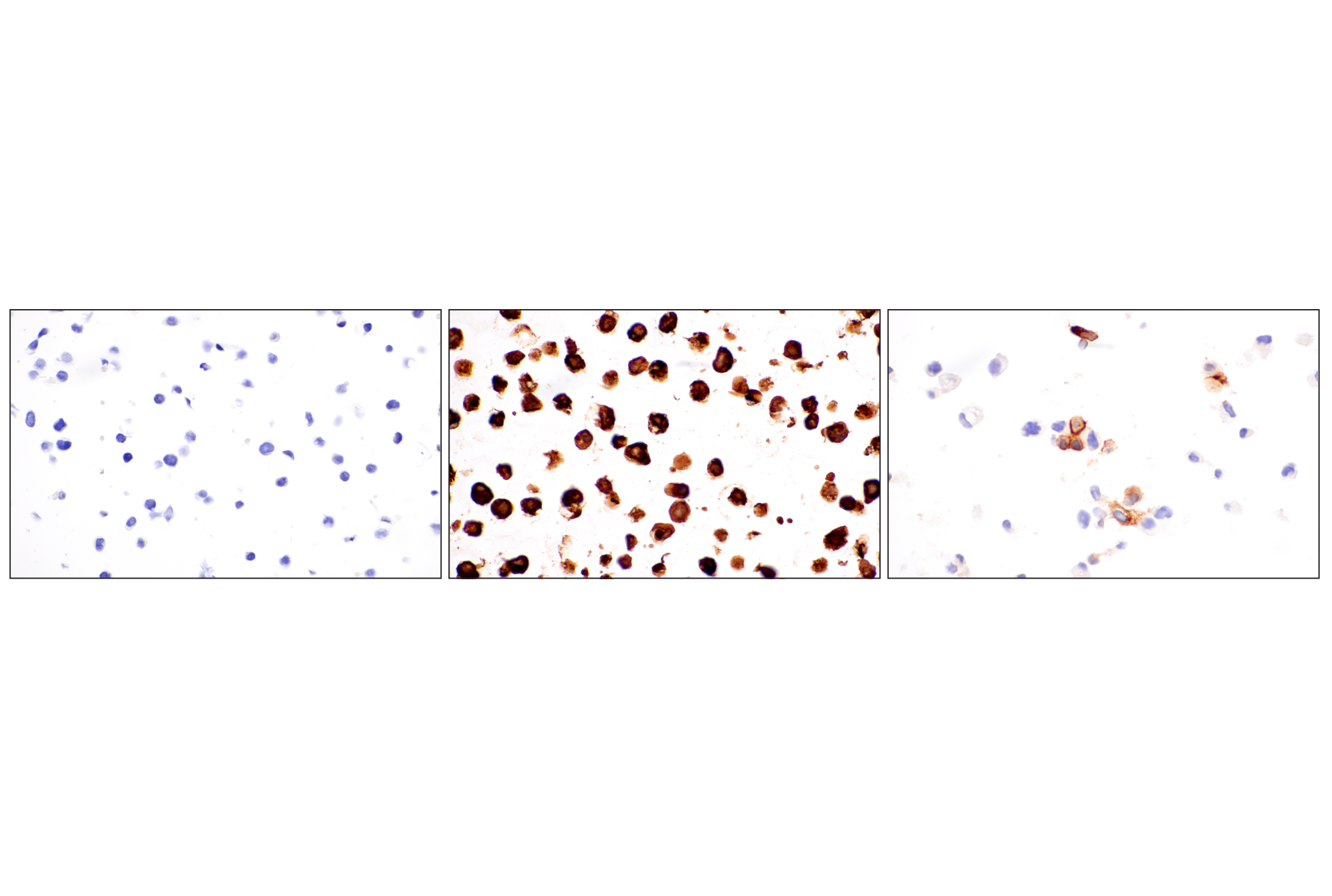 CEACAM7 (E5Q6X) Rabbit mAb (BSA and Azide Free) | Cell Signaling Technology