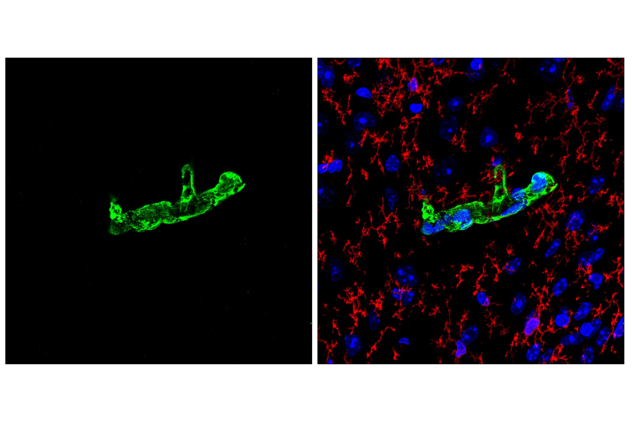 Transgelin/TAGLN (F3B7H) Rabbit mAb | Cell Signaling Technology
