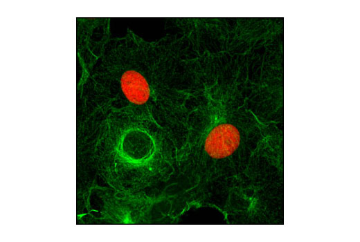 Myc-Tag (9B11) Mouse mAb (Alexa Fluor® 555 Conjugate) | Cell Signaling ...