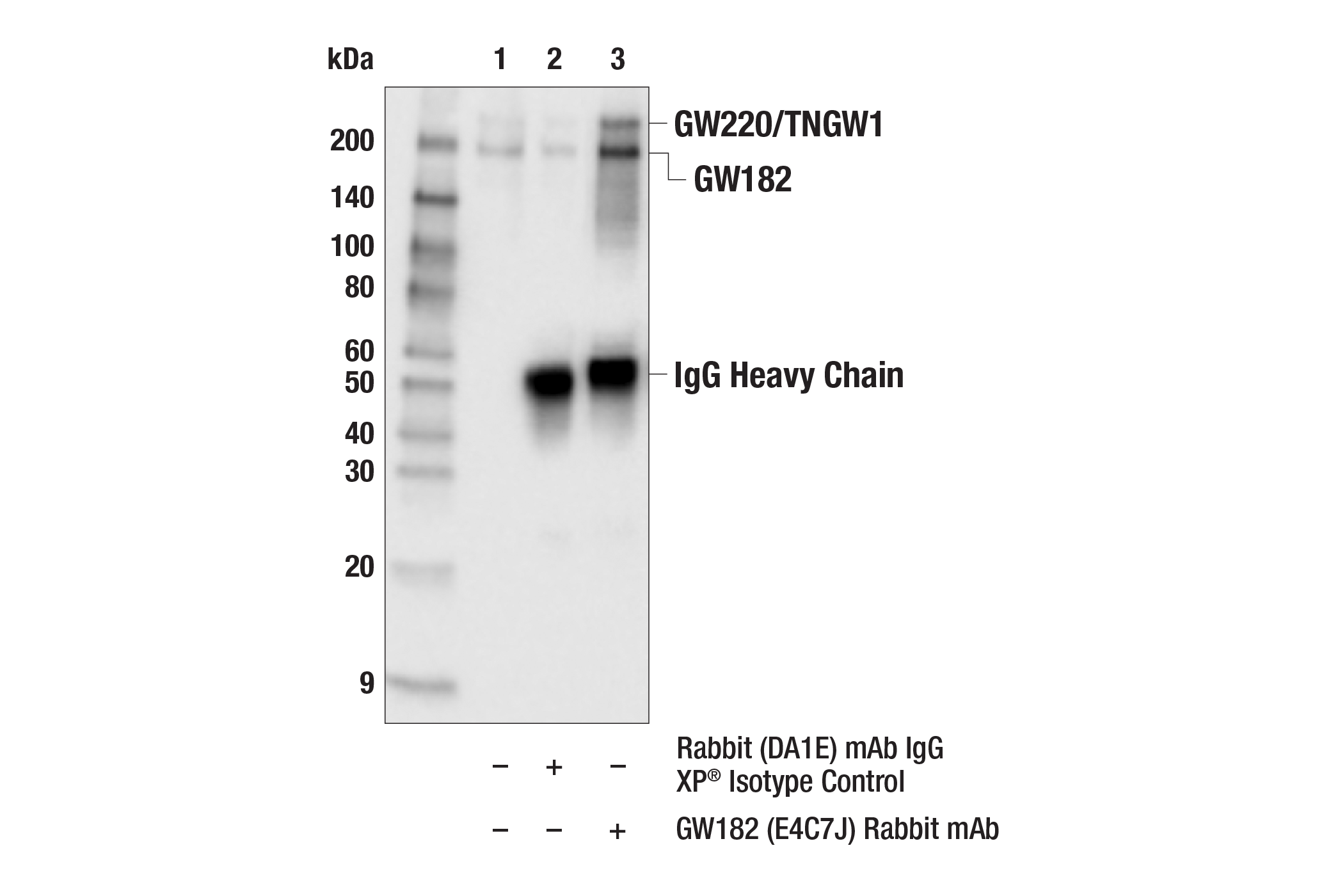 GW182 (E4C7J) Rabbit mAb | Cell Signaling Technology