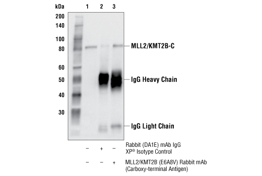 MLL2/KMT2B (E6A8V) Rabbit mAb (Carboxy-terminal Antigen) | Cell ...