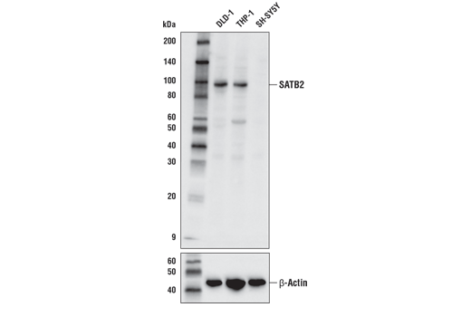 SATB2 (E4N4A) Rabbit mAb | Cell Signaling Technology