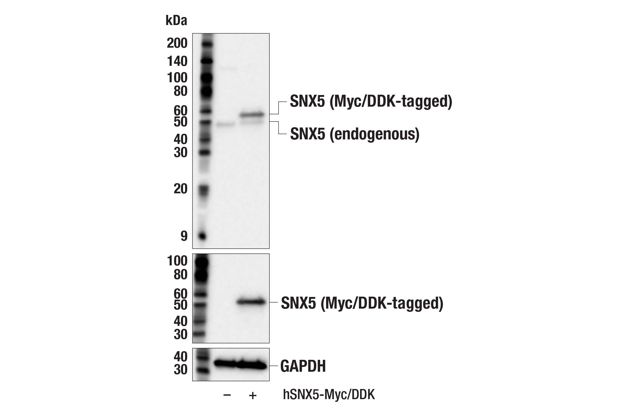 SNX5 (E4Q2X) Rabbit mAb | Cell Signaling Technology