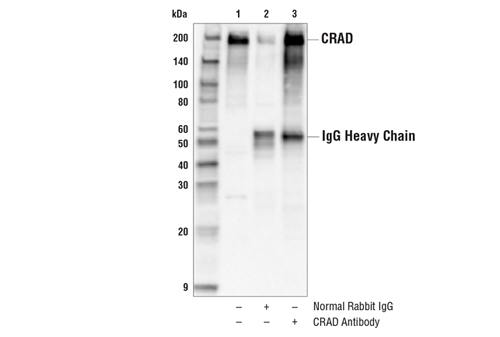CRAD Antibody | Cell Signaling Technology