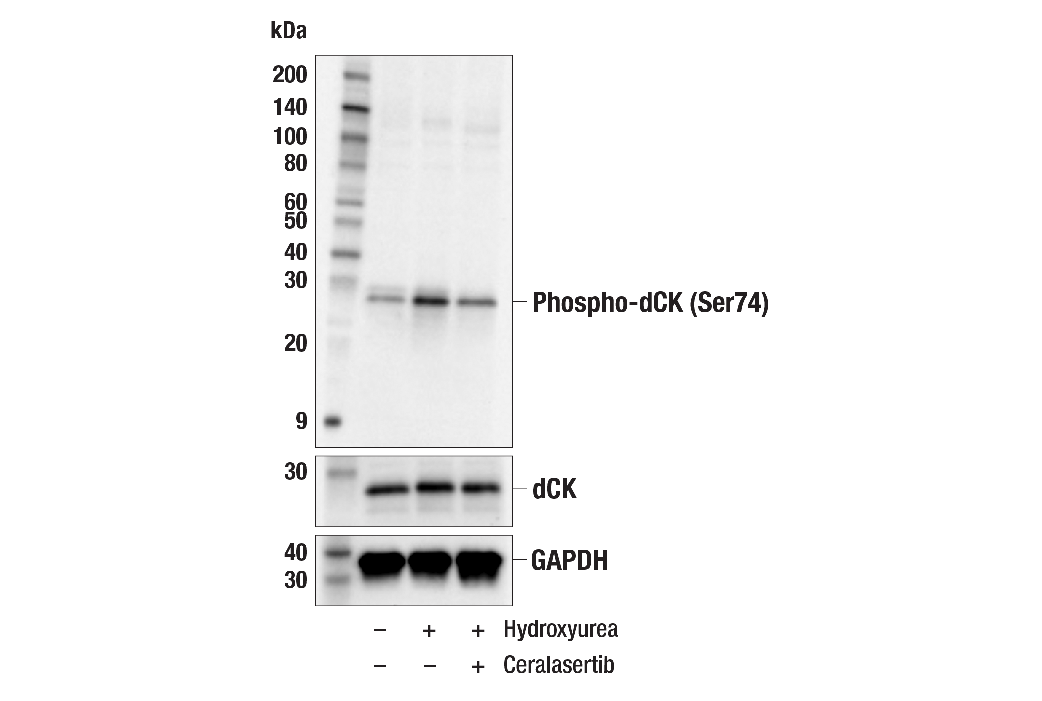 Phospho-dCK (Ser74) Antibody | Cell Signaling Technology